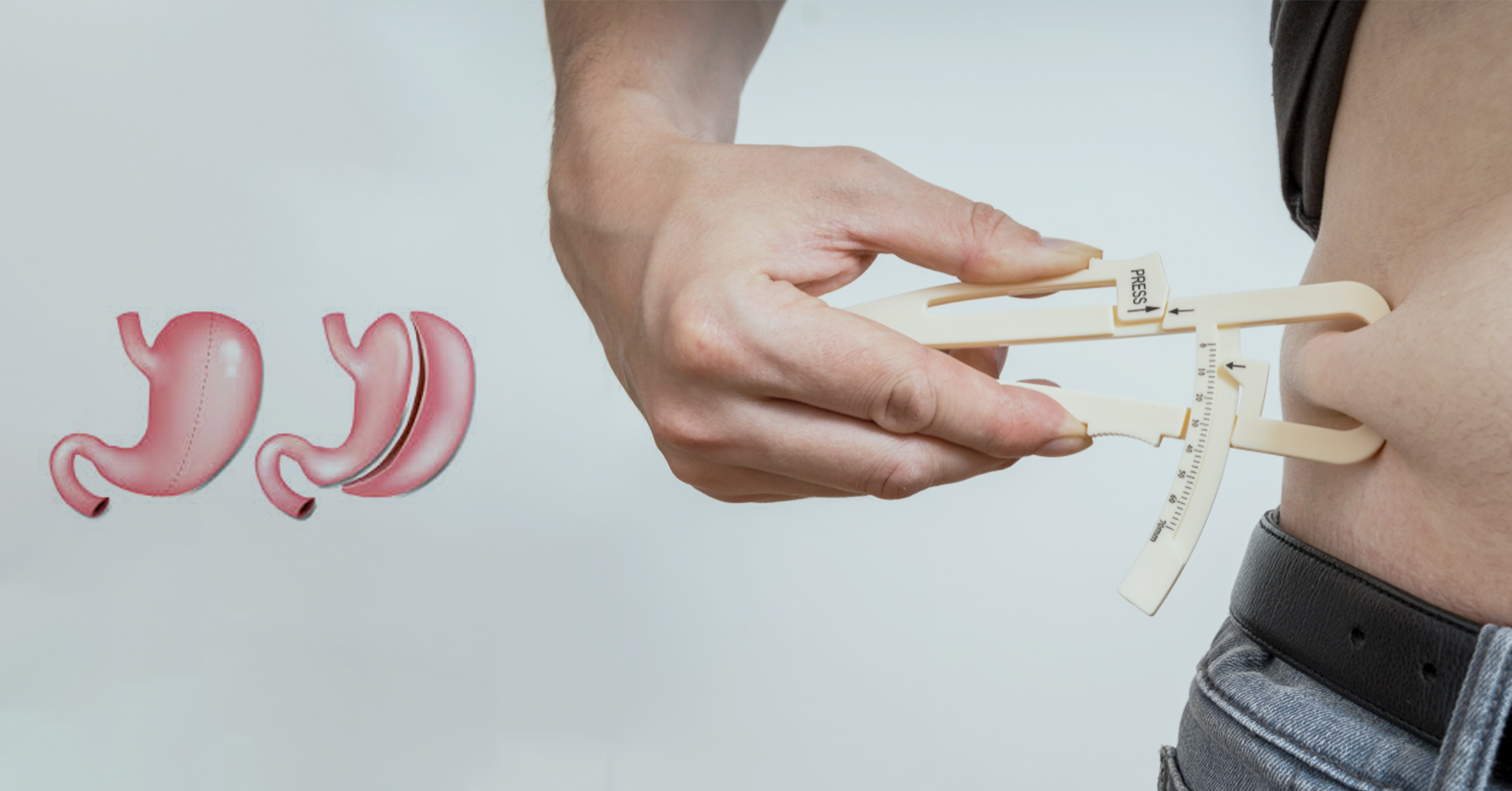 What is Bariatric surgery? Is it Called Weight-loss surgery or Obesity ...